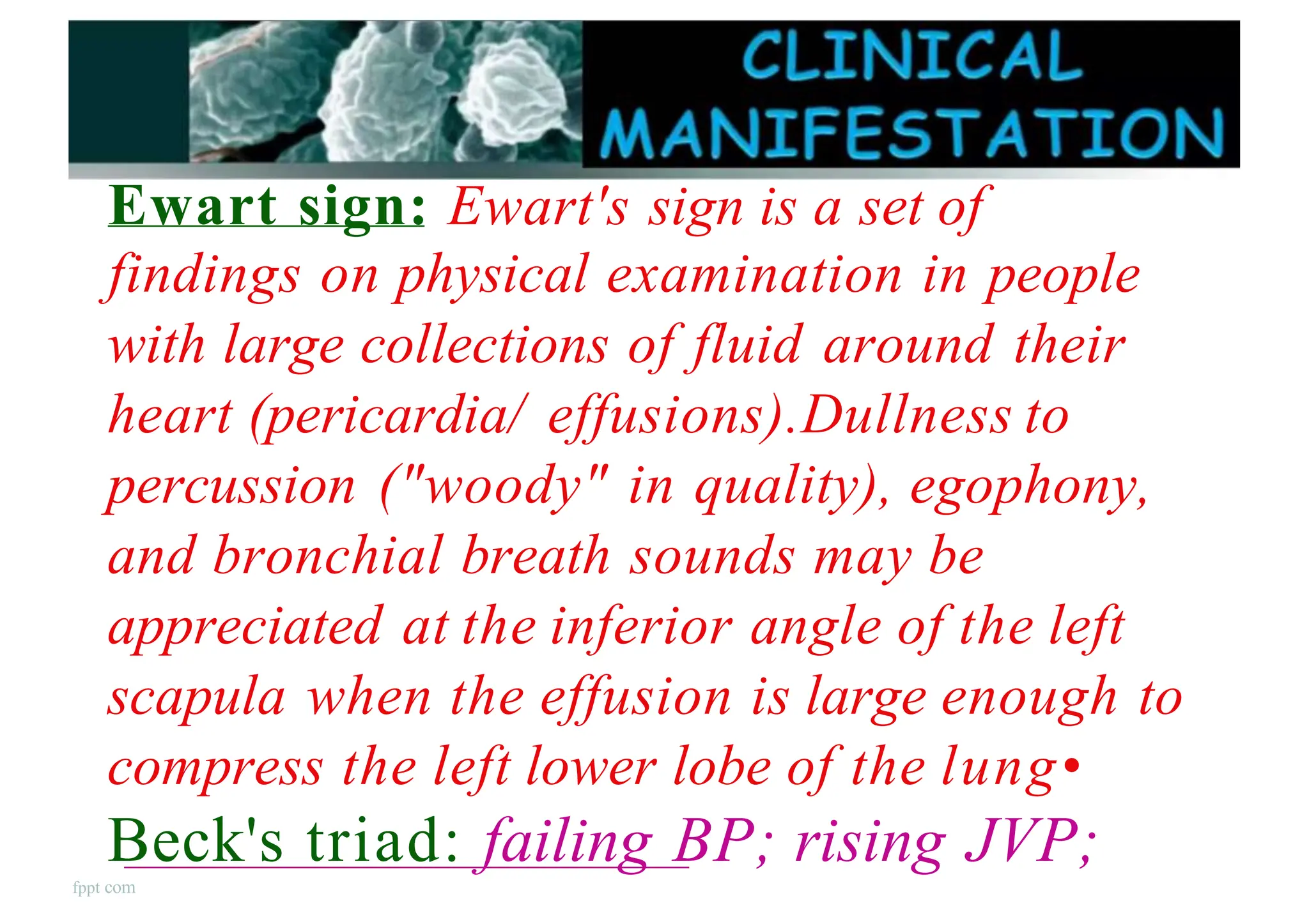 Pericarditis is inflammation of the pericardium (the fibrous sac ...
