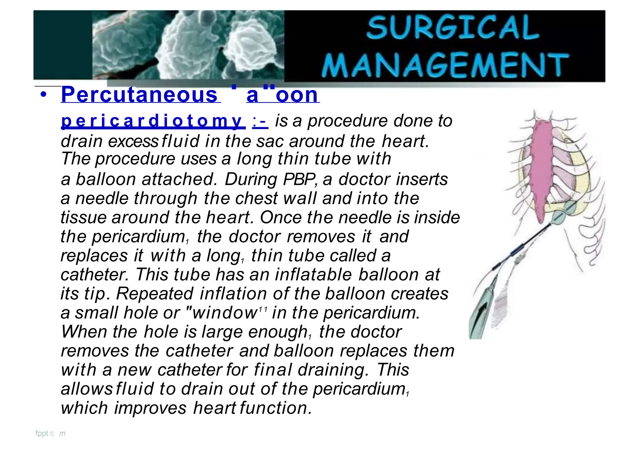 Pericarditis is inflammation of the pericardium (the fibrous sac ...