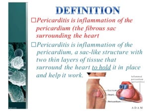 Pericarditis is inflammation of the pericardium (the fibrous sac ...