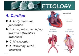 Pericarditis is inflammation of the pericardium (the fibrous sac ...