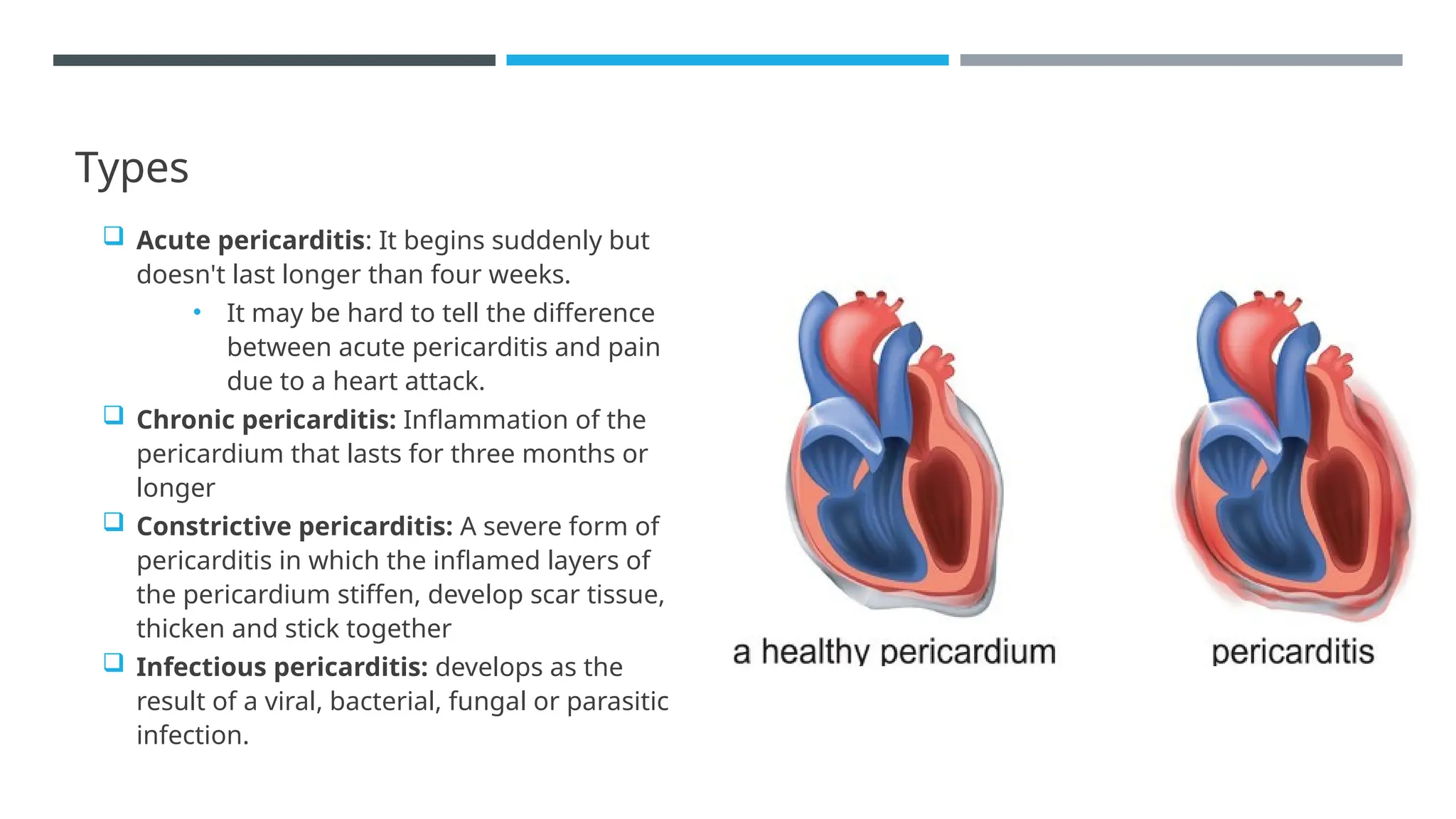 Identify the symptoms and clinical manifestations of Pericarditis | PPT