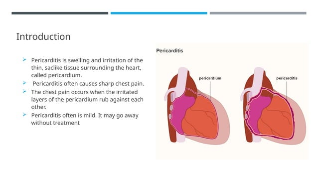 Identify the symptoms and clinical manifestations of Pericarditis | PPT