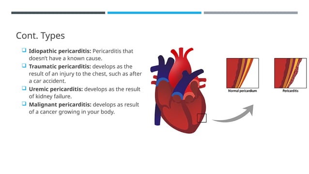 Identify the symptoms and clinical manifestations of Pericarditis | PPT