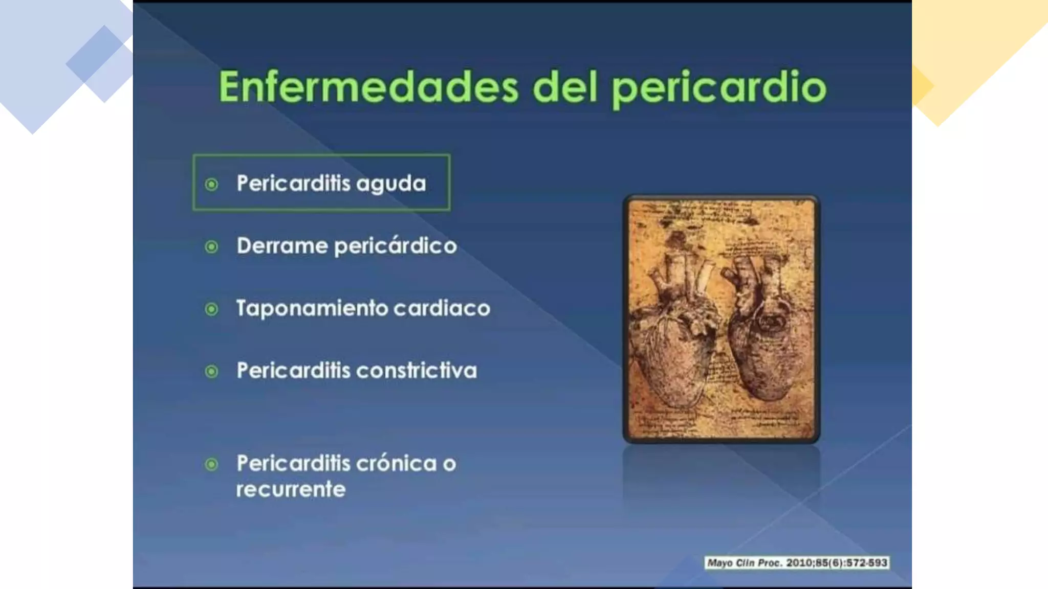 pericarditis aguda.pptx
