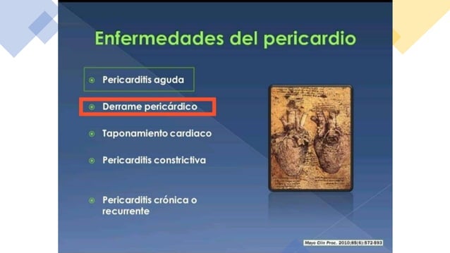 pericarditis aguda.pptx