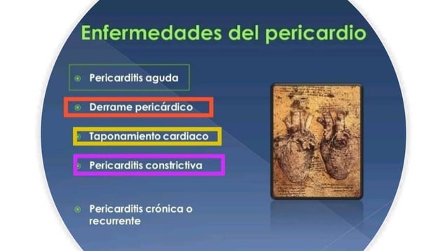 pericarditis aguda.pptx
