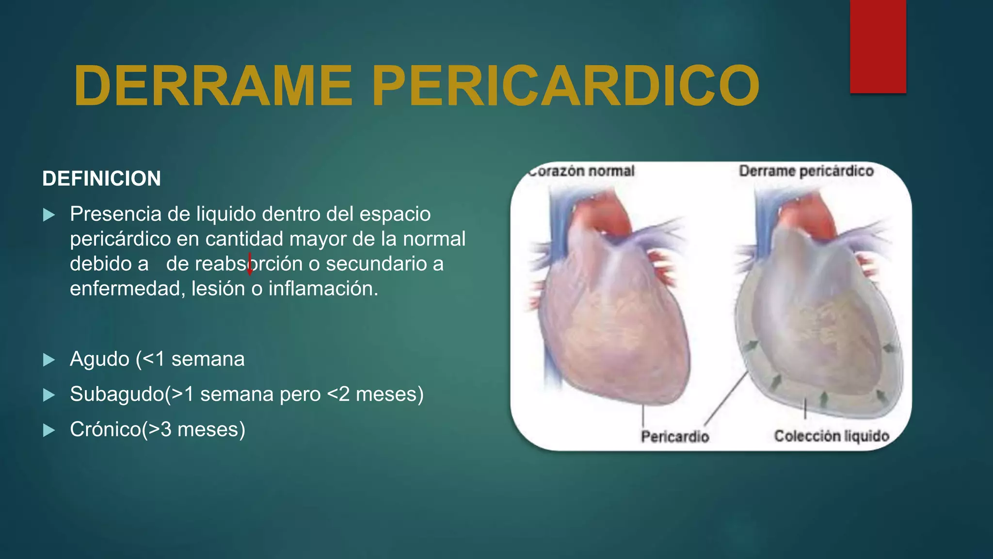 Pericarditis, derrame pericardico y taponamiento cardiaco | PPTX