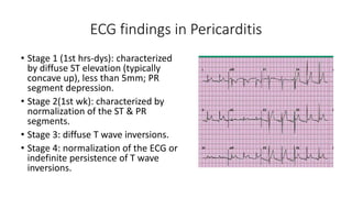 Pericarditis for student | PDF
