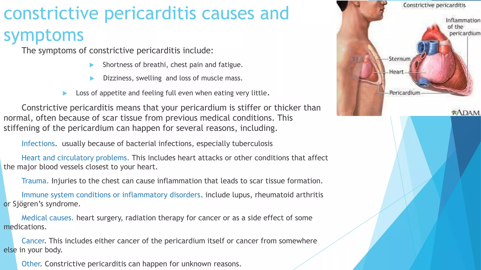 pericarditis.pptx