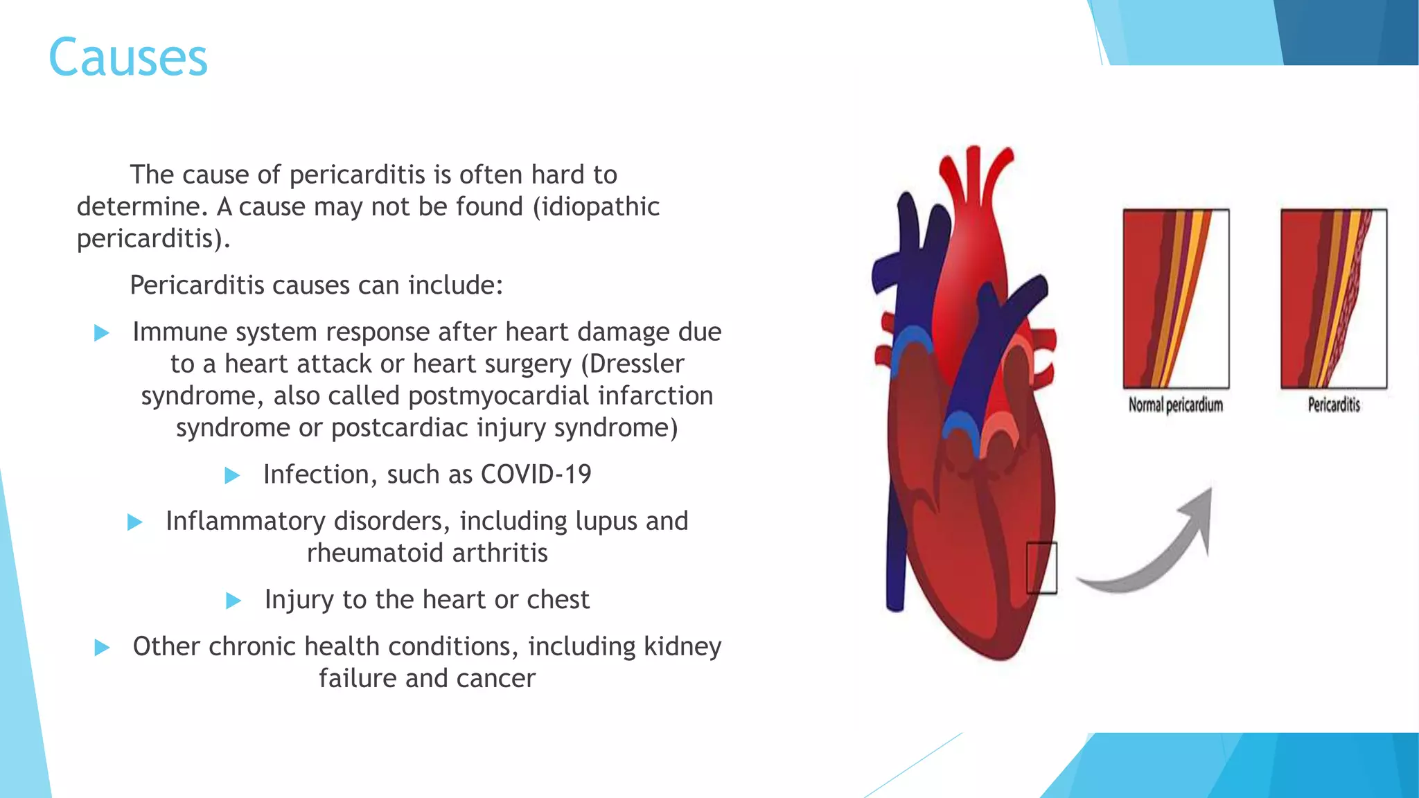 pericarditis.pptx