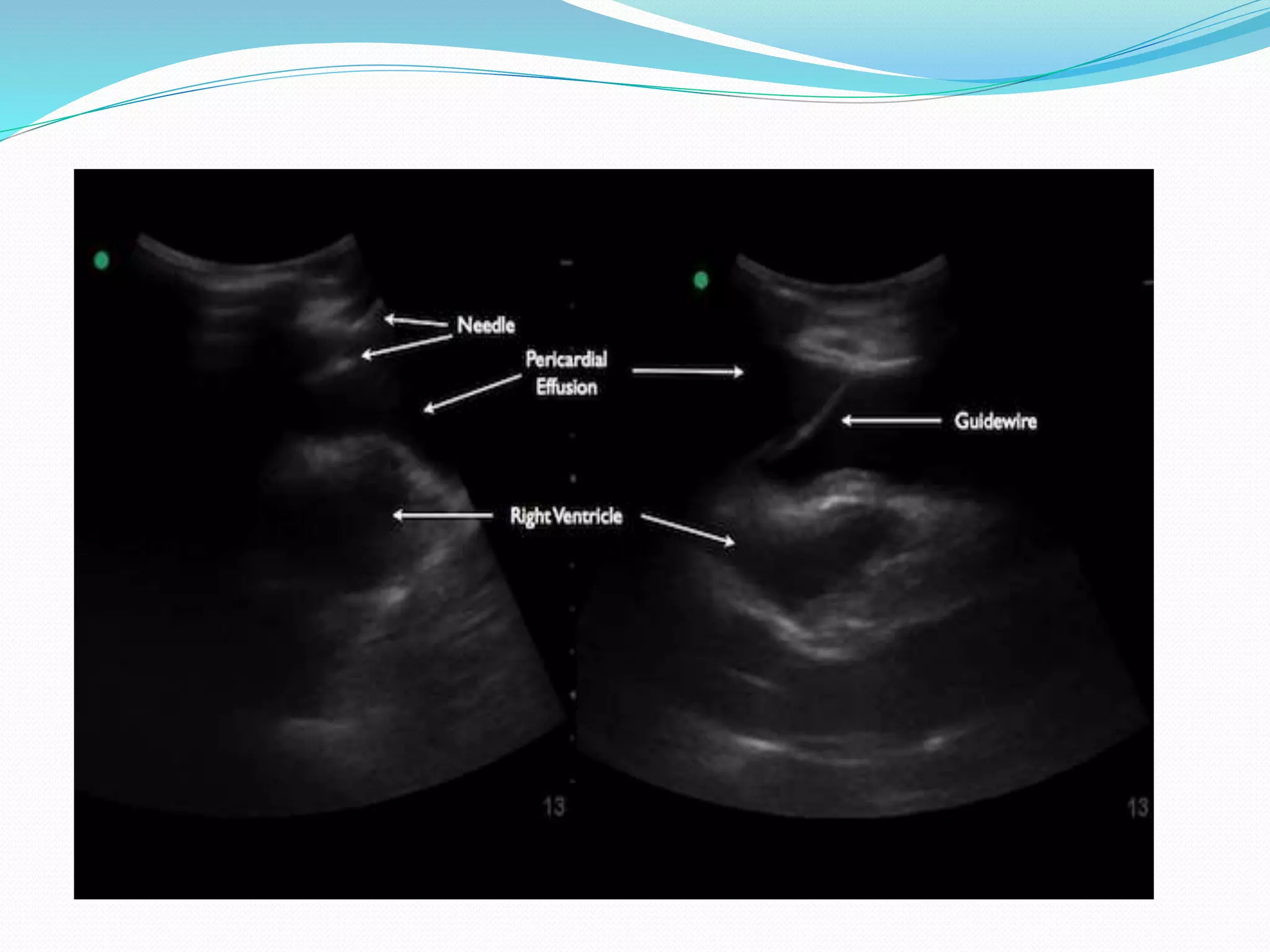 Pericarditis in animals | PPTX