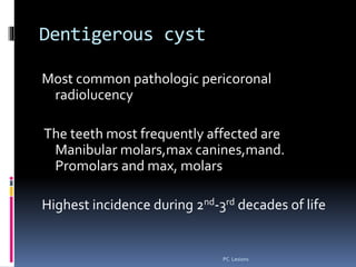 Pericoranal lesions.pptx