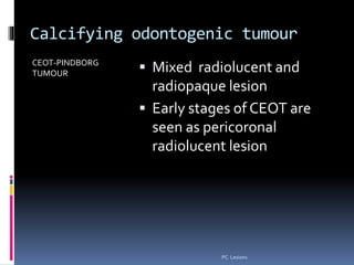 Pericoranal lesions.pptx