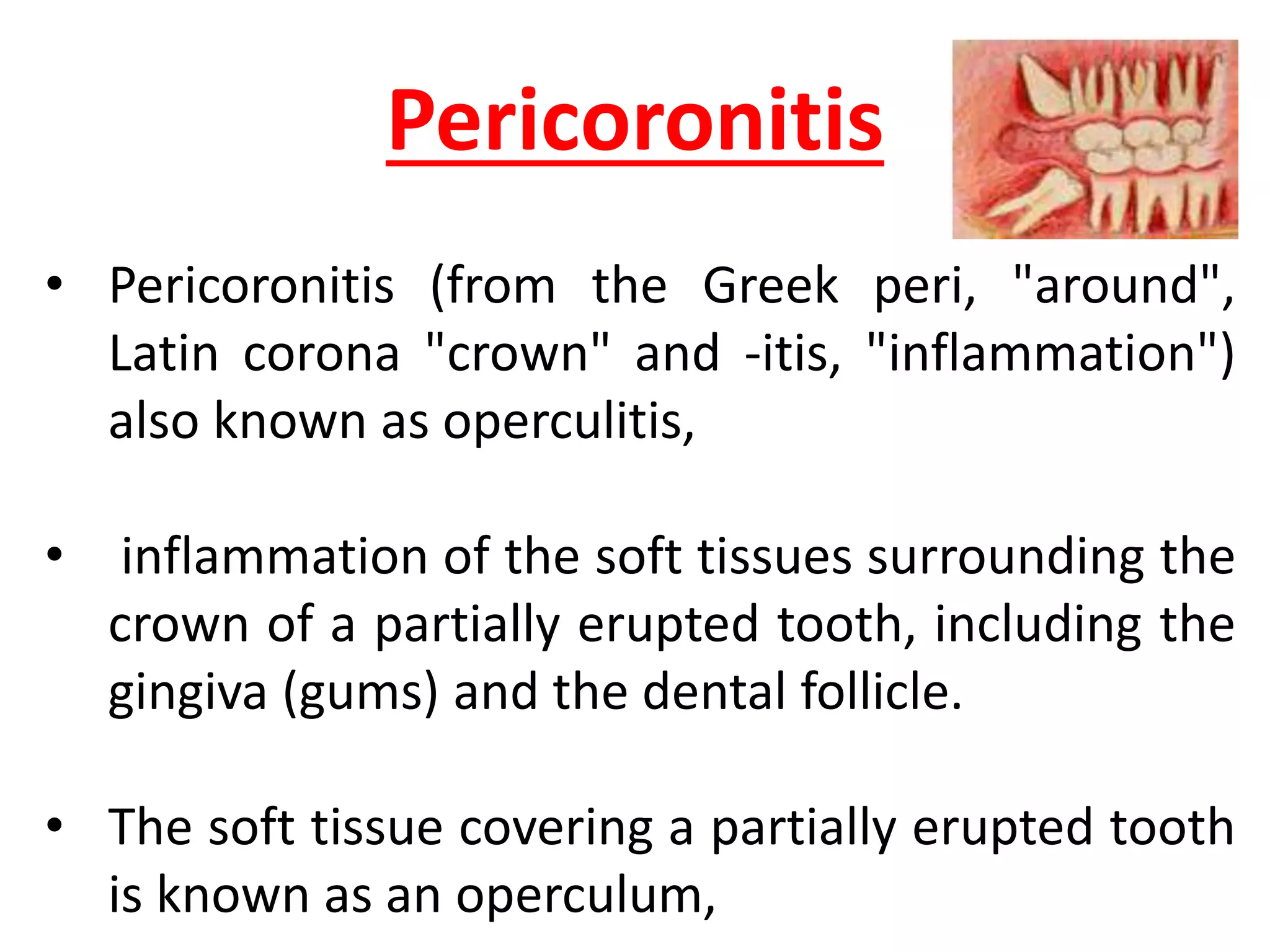 Pericoronitis | PPTX | Ear, Nose and Throat Conditions | Diseases and ...