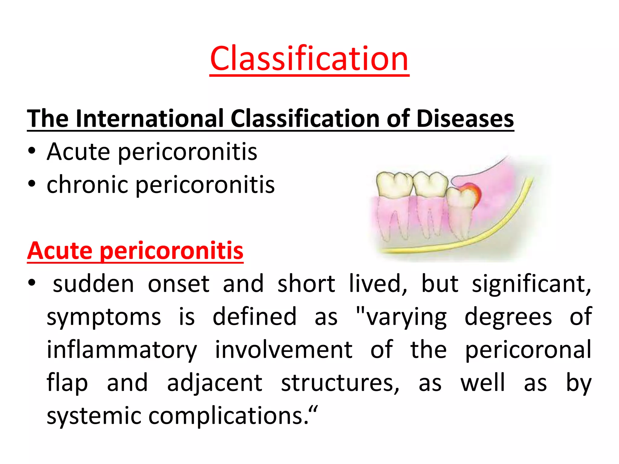 Pericoronitis | PPTX
