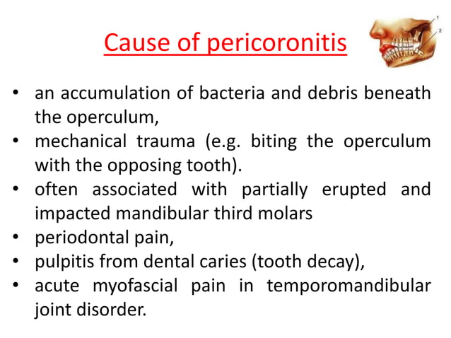 Pericoronitis | PPTX | Ear, Nose and Throat Conditions | Diseases and ...