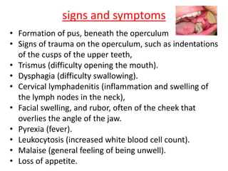 Pericoronitis | PPTX