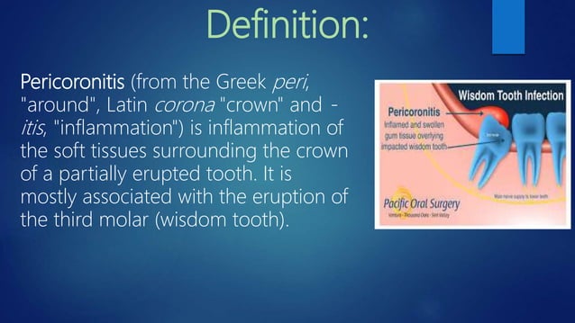 Pericoronitis | PPTX | Dental Health | Diseases and Conditions