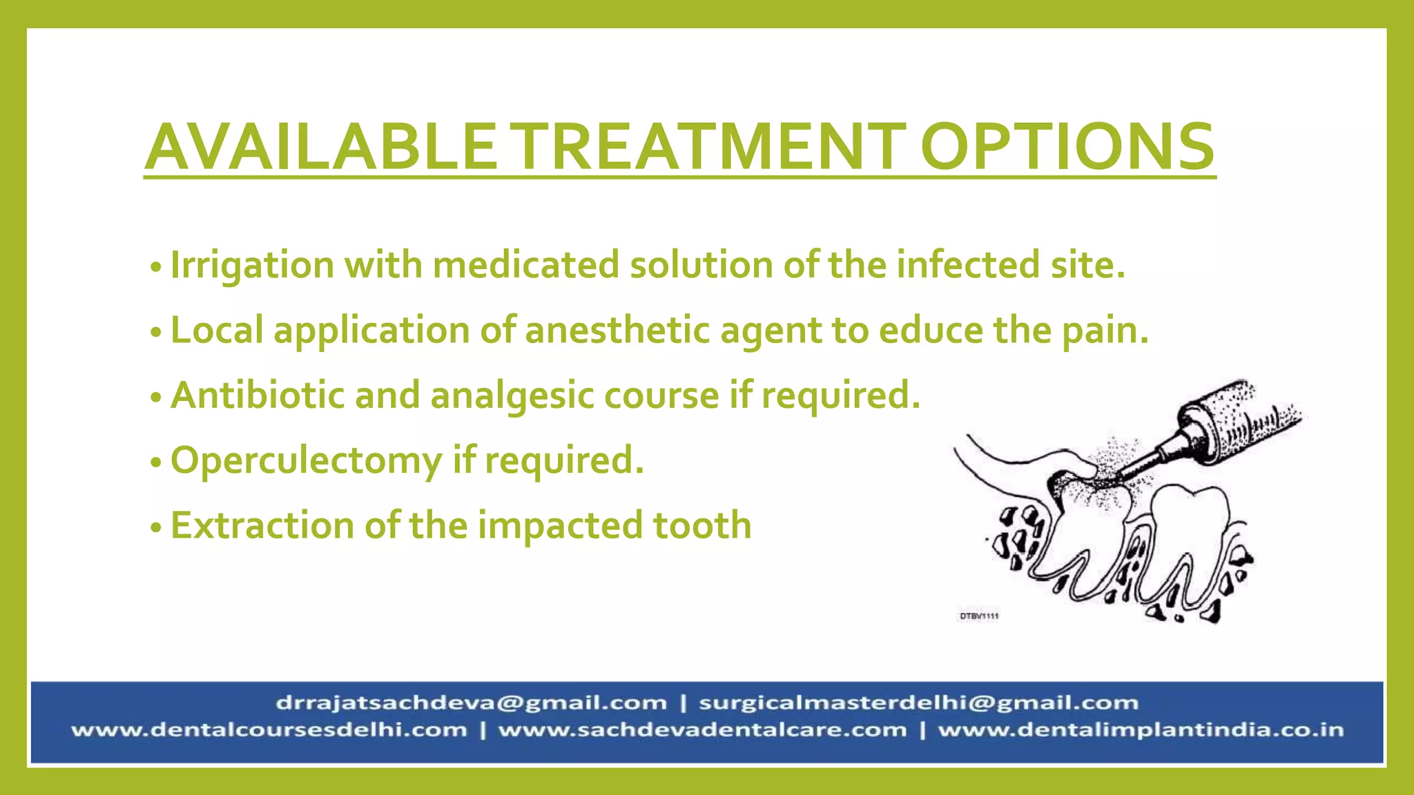 Pericoronitis | PPTX