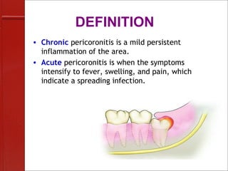 Pericoronitis | PPT