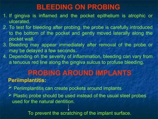 Peridontal-Pocket-Perio study guide exam | PPT