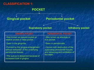 Peridontal pocket | PPT