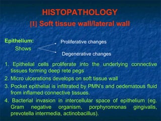 Periodontology __periodontal pocket ____ | PPT