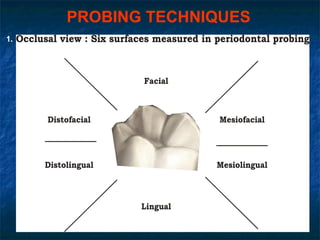Periodontology __periodontal pocket ____ | PPT