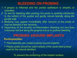 Periodontology __periodontal pocket ____ | PPT
