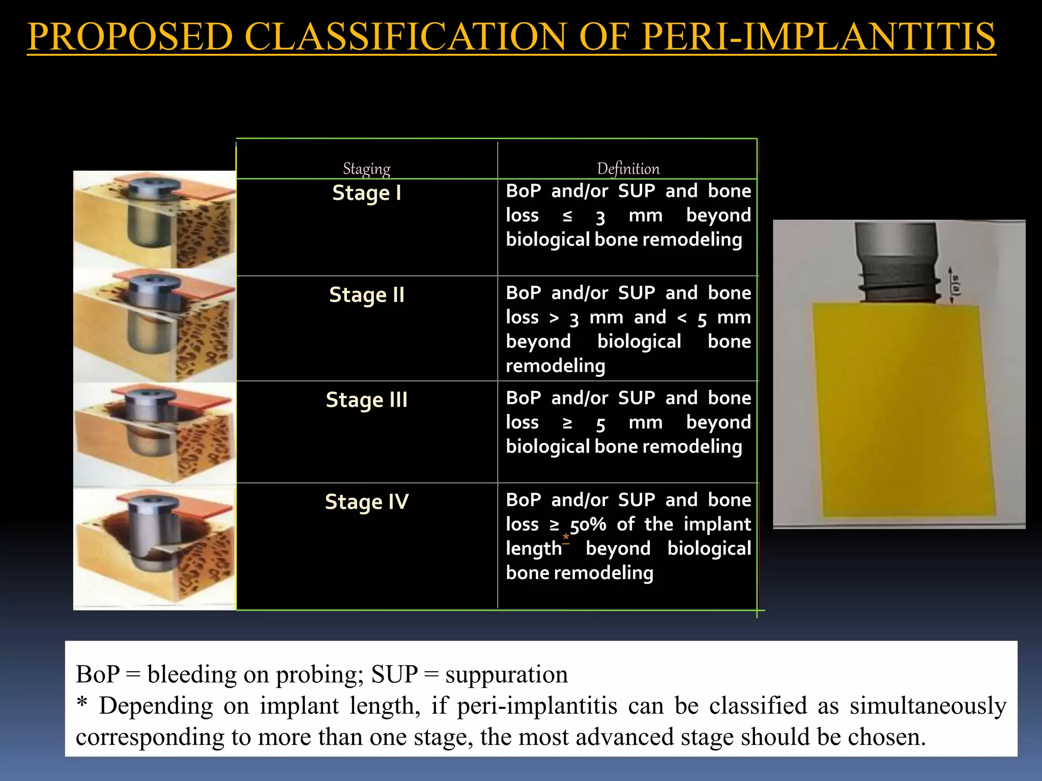 Peri implantitis | PPTX