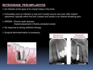 Peri implantitis | PPTX