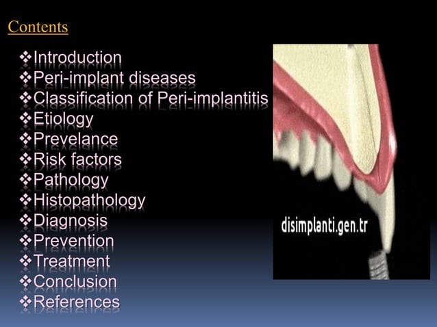 Peri implantitis | PPTX