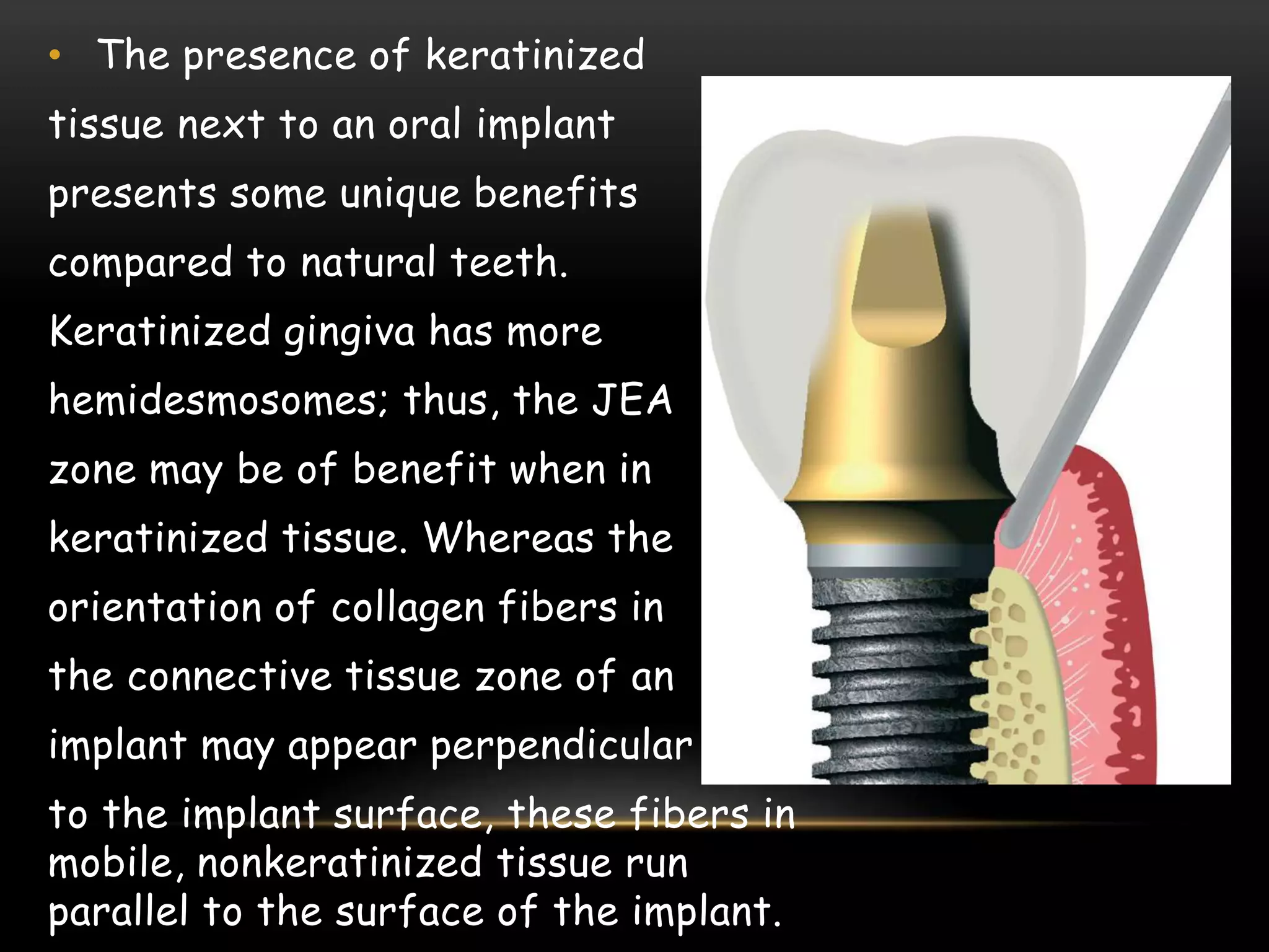 Periimplantitis | PPTX