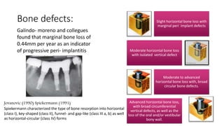 Peri implant diseases and its management | PPTX