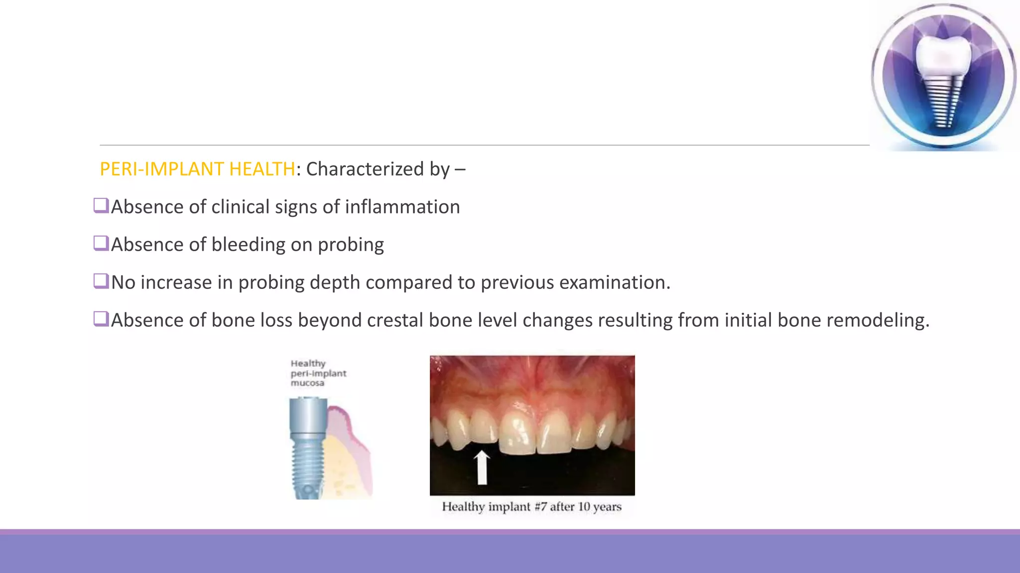 Periimplantitis | PPTX