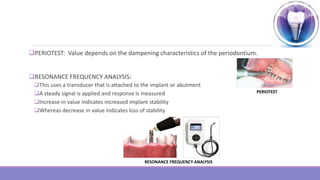 Periimplantitis | PPTX