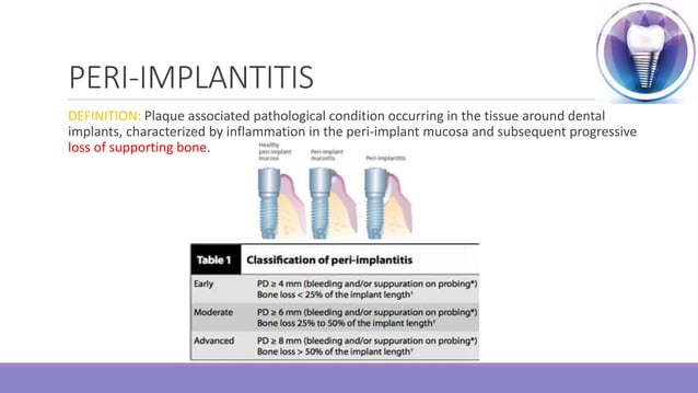 Periimplantitis | PPTX
