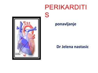 Perikarditis | PPTX