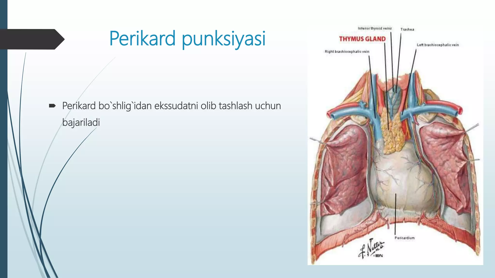 Perikard punksiyasi | PPTX