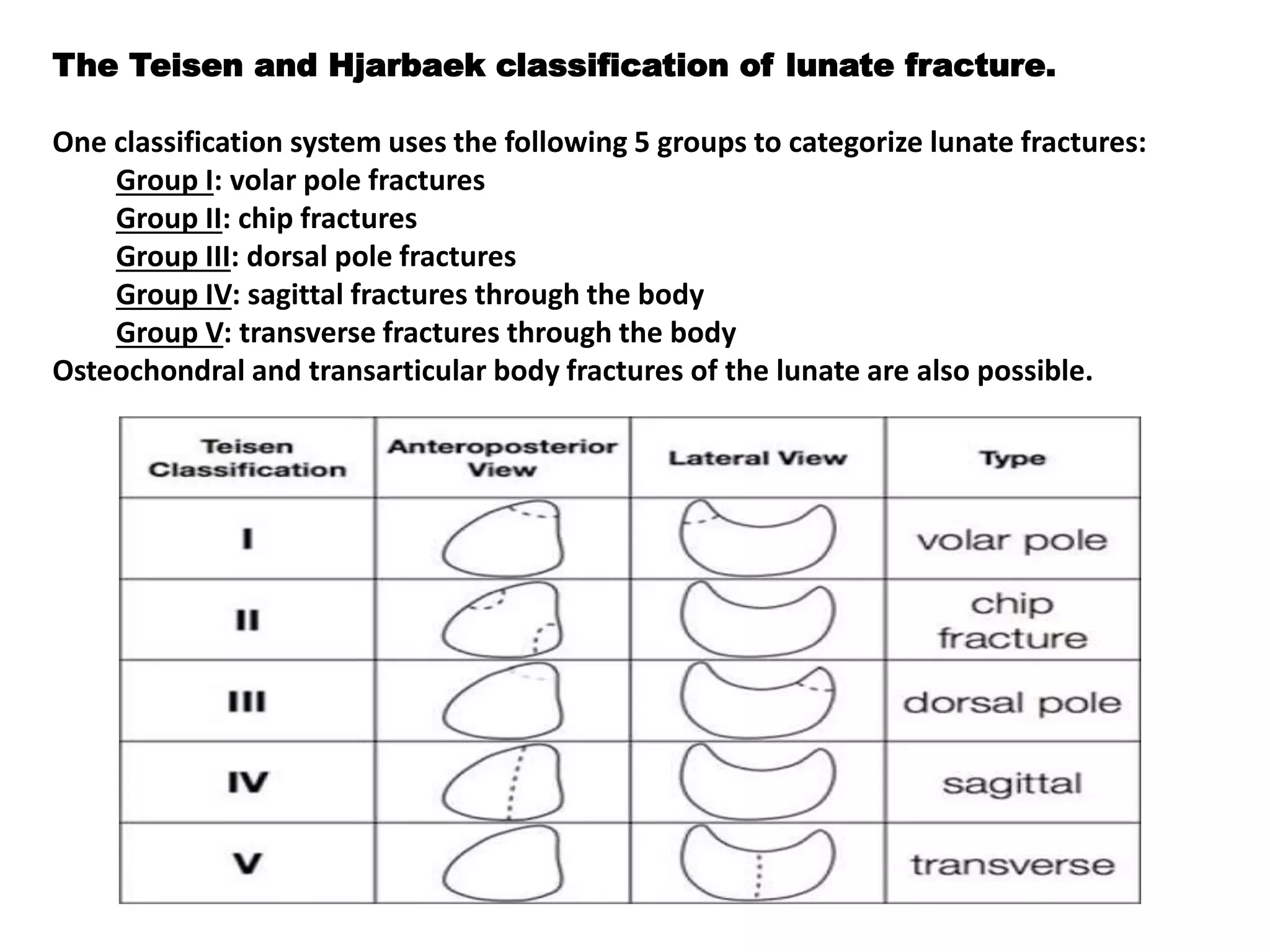 Lunate Fracture & Perilunate dislocation of carpals by Dr.@rpan ...