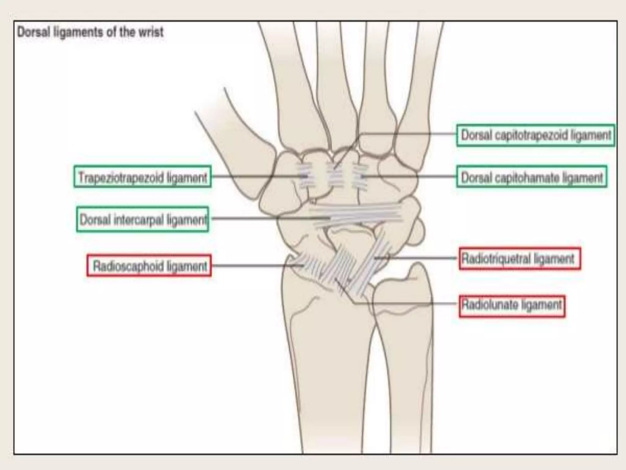 Lunate Fracture & Perilunate dislocation of carpals by Dr.@rpan ...