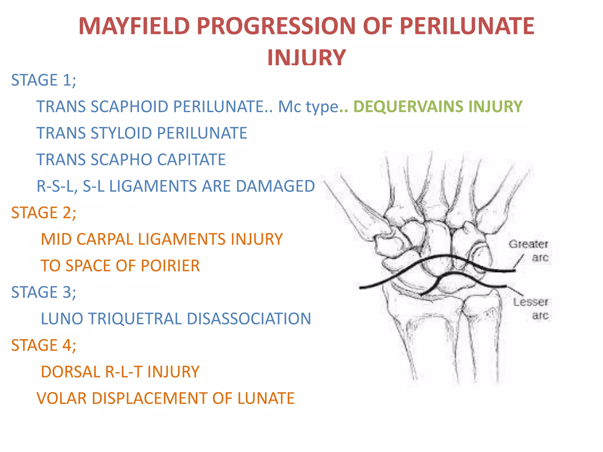 Perilunate dislocation, carpal injuries | PPTX