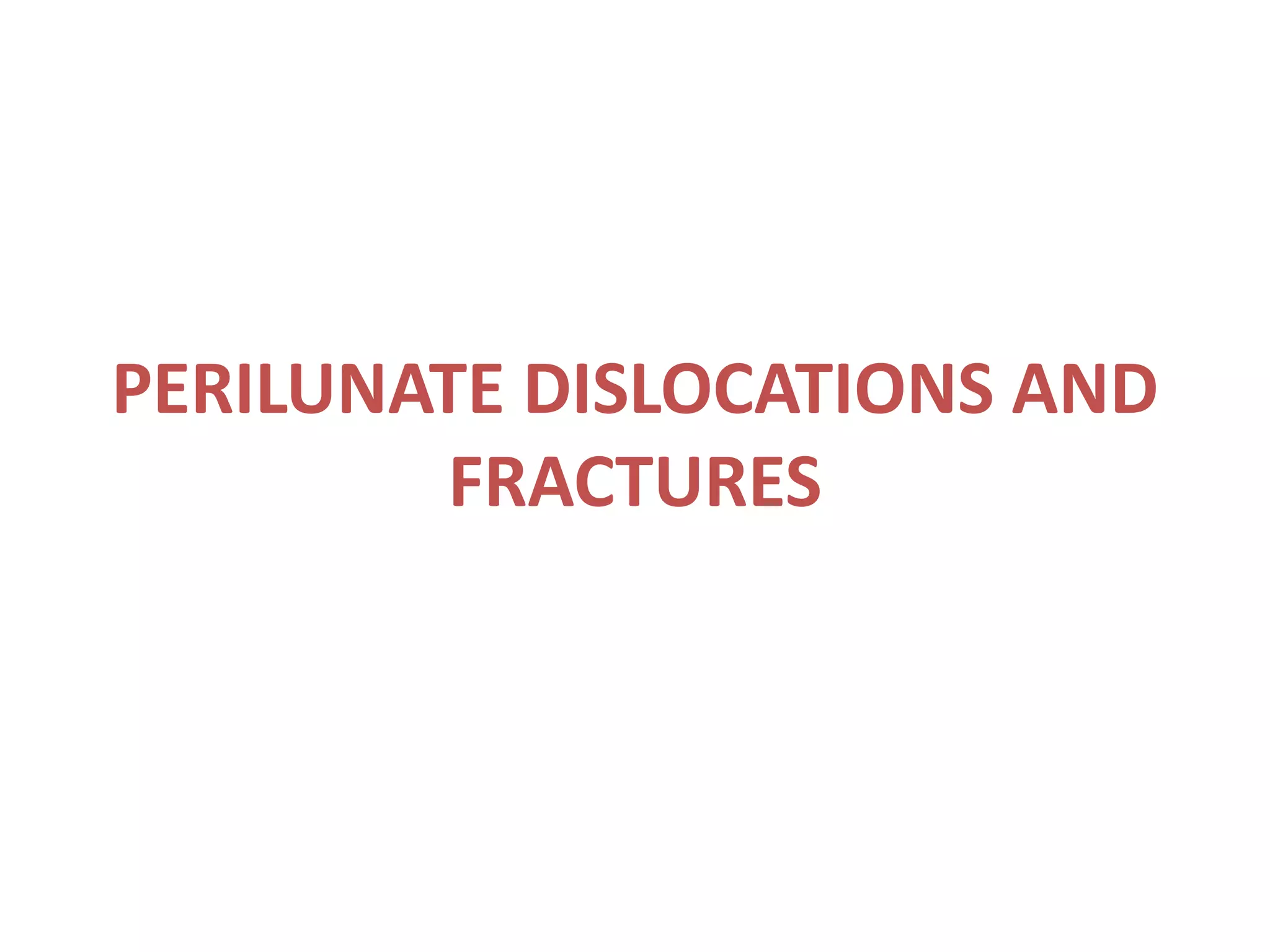 Perilunate dislocation, carpal injuries | PPTX