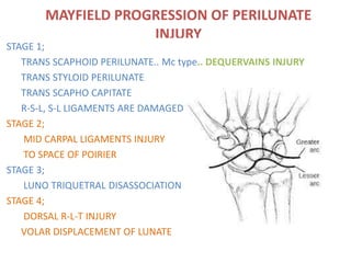 Perilunate dislocation, carpal injuries | PPTX