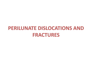 Perilunate dislocation, carpal injuries | PPT