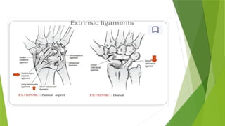 Perilunate fracture dislocation jpg.pptx