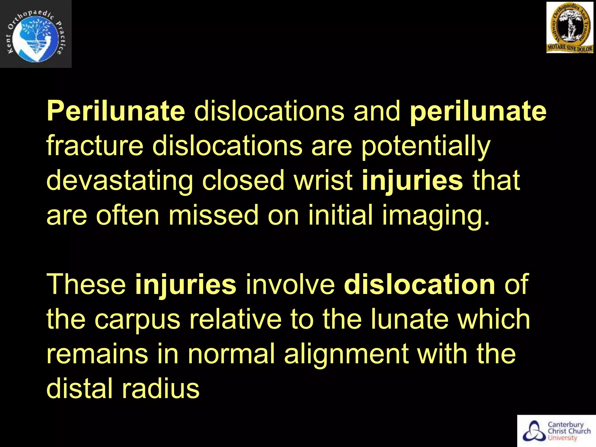 Perilunate injuries | PPTX