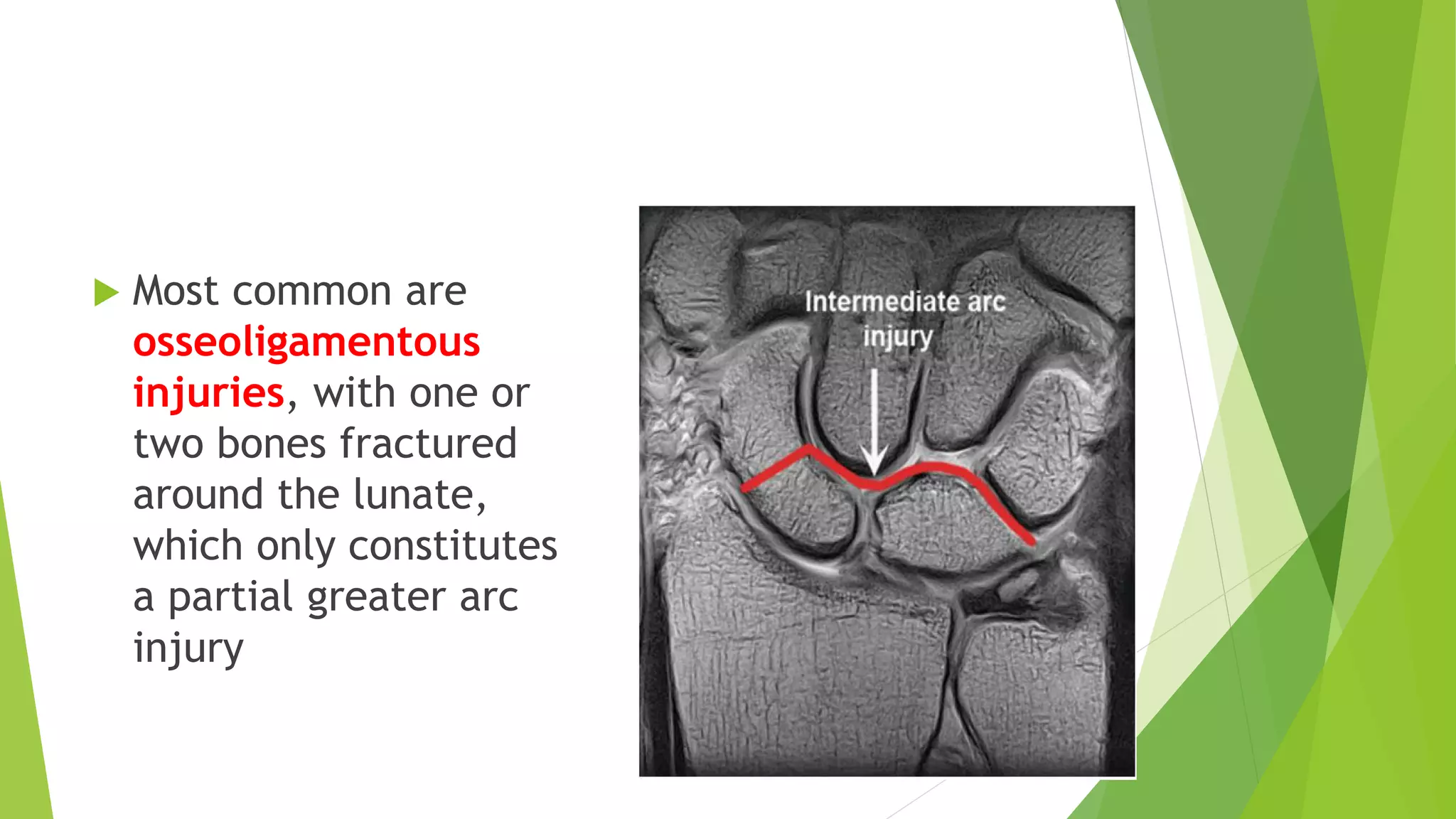 Perilunate injuries and lunate dislocations [Autosaved].pptx