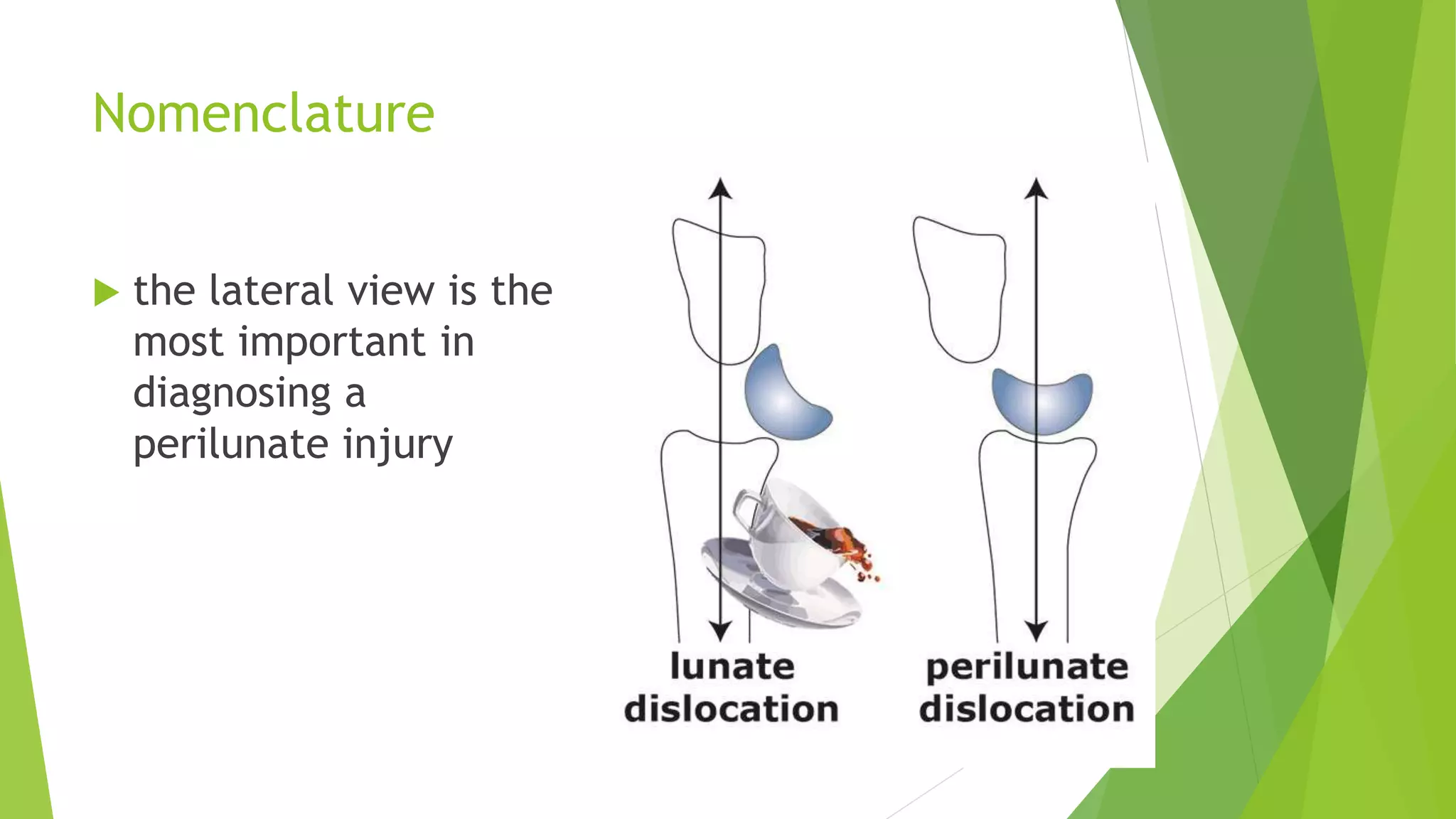 Perilunate injuries and lunate dislocations [Autosaved].pptx