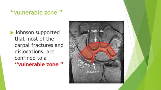 Perilunate injuries and lunate dislocations [Autosaved].pptx